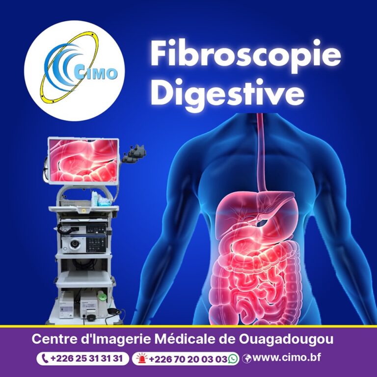 Fibroscopie Digestive - CIMO
